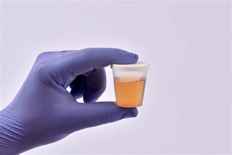 Urine Dipstick Test