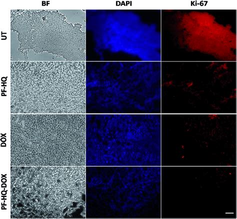 immunohistochemistry ki 67 analysis of untreated tumor tissue and