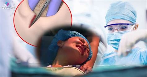 C Bao Nhi U M Y Hi U Ng V R Ch V Kh U T Ng Sinh M N Khi Sinh Th Ng