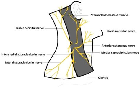 Successful Ultrasound Guided Superficial Cervical Plexus Block
