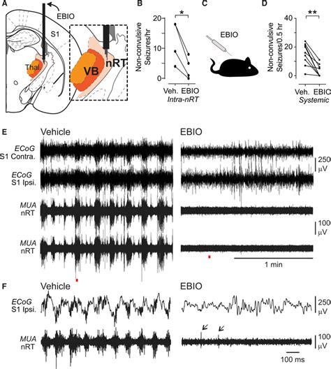 Local Or Systemic Ebio Treatment Reduces Non Convulsive Seizure Download Scientific Diagram