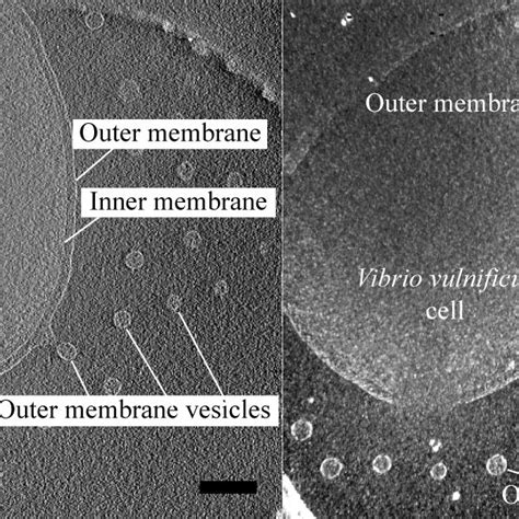 Cilia Ultrastructure Observed By Transmission Electron Microscopy A