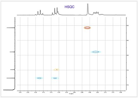 Solved NMR Data Show Your Work Answers On The NMR Chegg Com