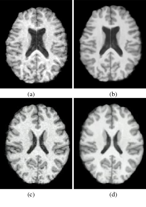 Figure 1 From Consistent Groupwise Non Rigid Registration For Atlas Construction Semantic Scholar