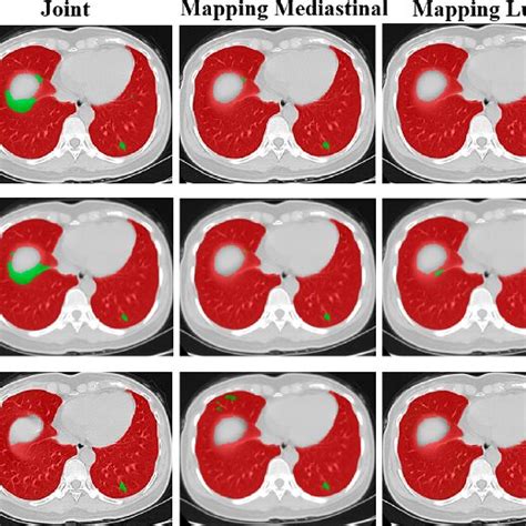 Examples Of Two Types Of Thick Slice Lung Ct Images Left Image Download Scientific Diagram