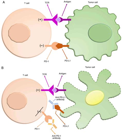 Pd L1 негативная