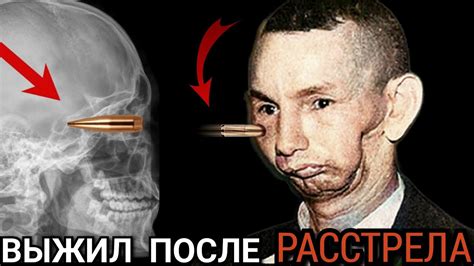 😱 Истории Людей ВЫЖИВШИХ После РАССТРЕЛА в ГОЛОВУ Youtube