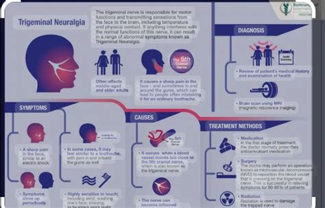 Dr Abdur Rahim On Linkedin Trigeminal Neuralgiaemergency Rx Mvd