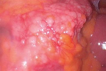 Women S Health Symptoms Diagnosis And Treatment GPonline