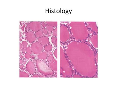 Benign Thyroid Conditions Pptx