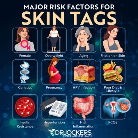 Skin Tags Major Causes And Natural Support Strategies