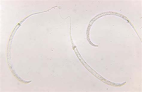 What Do Human Parasites Look Like What Do Human Parasites Look Like