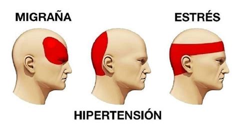 Dolor En La Parte Derecha De La Cabeza ️ Mentalidad Humana