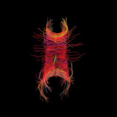 Bootstrap And Closest Peak Direction Getters Example — Dipy 1110 Documentation