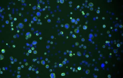 Mohamed Essameldin Abdelgawad On Linkedin Large Scale Production Of