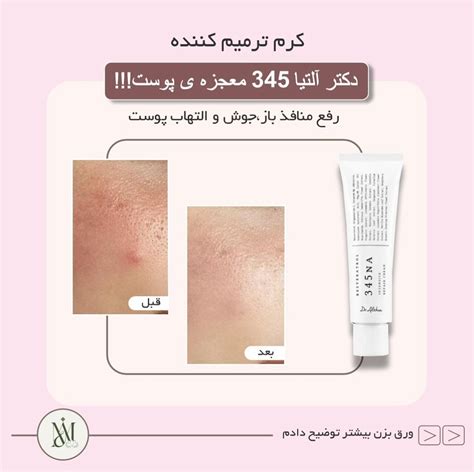 Originalshopmarii ‎⚪️کرم ترمیم کننده سیکالفیت اون واقعا این محصول