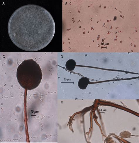 Molecular Phylogeny Identification And Pathogenicity Of 56 Off