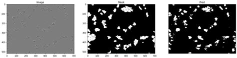results of the segmentation u net super resolved downsampled image