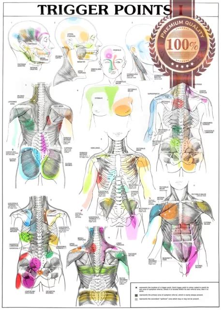 Trigger Points Part 1 Anatomical Diagram Chart Anatomy Print Premium Poster Eur 1493 Picclick It