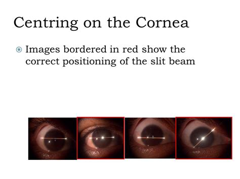 Getting The Markings Right Ppt Download