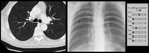 The Visual Representations Used During The Tls Ct Left Ts Middle Download Scientific