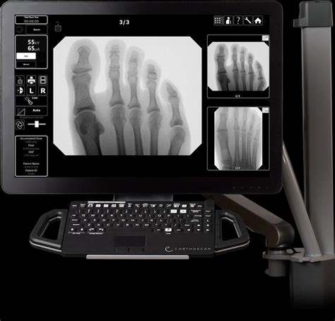 Fluoroscopy Scan Information Sigmadigital X Ray