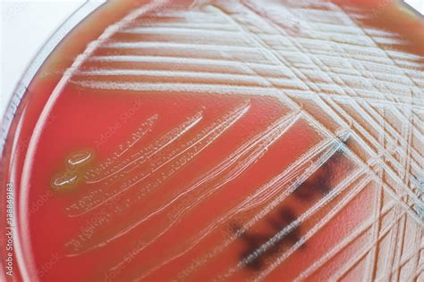 Streptococcus Suis Gram Positive To Gram Variable Nonmotile Coccus Saprotrophic Bacterium