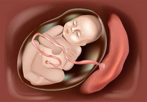 Best Umbilical Cord No Cord Stem Cell Transplant