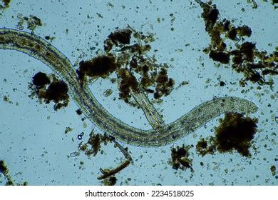 646 Parasites Scalp Images Stock Photos Vectors Shutterstock