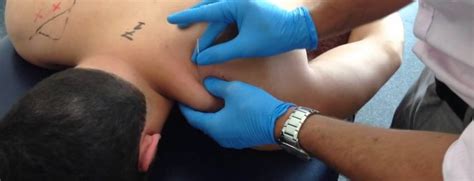 Dry Needling Practitioners