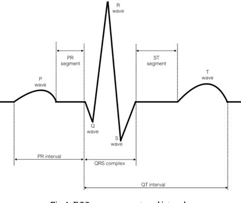 Figure 1 From Wavelet Packet Based Algorithm For Qrs Region Detection