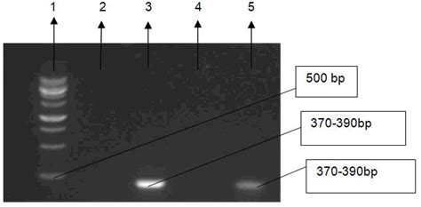 Validation Of Its3 Primer For The Plant Vigna Radiata