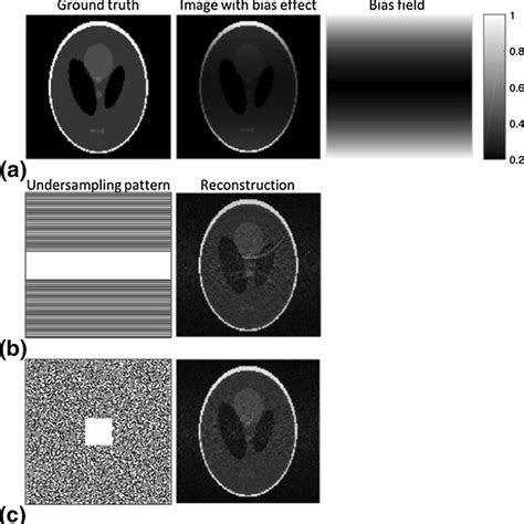 parallel imaging and compressed sensing pics reconstruction workflow
