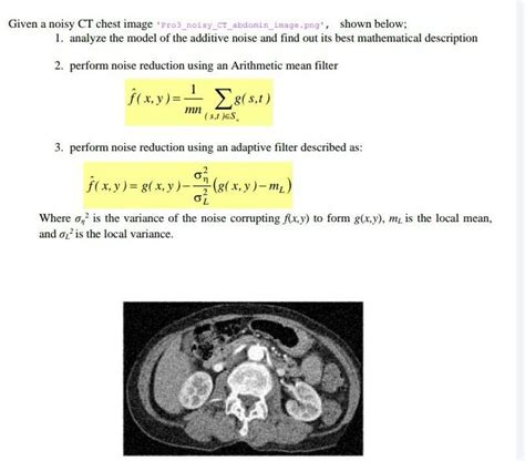 Solved Given A Noisy CT Chest Image Chegg