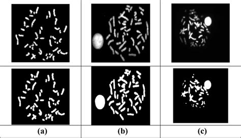 Segmentation Results For Watershed Transformation Download Scientific