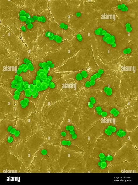 Coloured Scanning Electron Micrograph Sem Of Photocomposite Staphylococcus Aureus On The