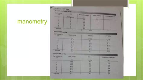 Epiphrenic Diverticulum Ppt