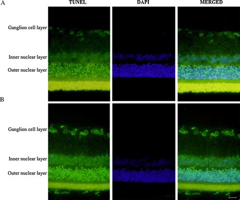 Apoptosis Detected In Retinal Cell By Tunel And Dapi Staining A