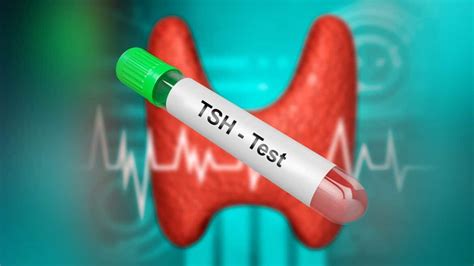 Mit Mutat A Tsh érték A Vérképben GyÓgyÁszportÁl