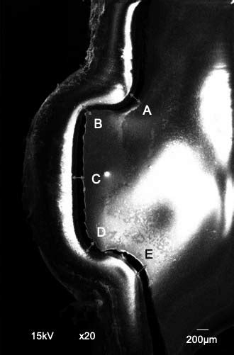 scanning electron microscope image showing the micrometric measurements