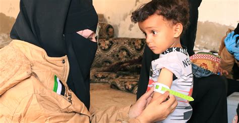 Targeting Malnutrition In Yemen With Treatment And Training