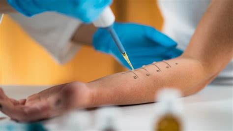 Scalp Psoriasis Causes Symptoms Treatment More Page 5 Entirely Health