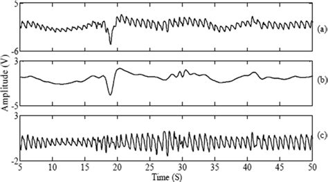 a original signal b generated movement signal c original signal minus