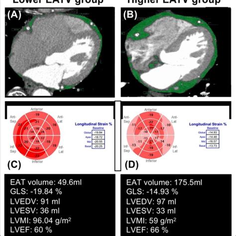 Diagrams Showing Different Parameters Rca Lad And Cx Measured In The Download Scientific