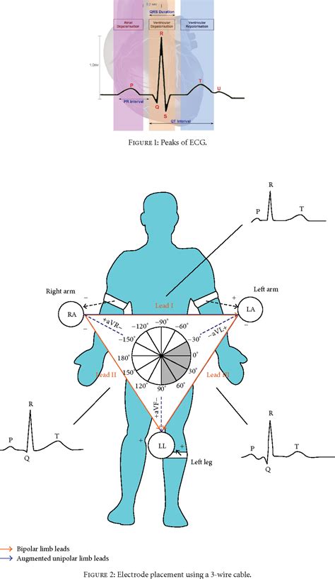 Figure 1 From Labview Based Ecg Patient Monitoring System For Cardiovascular Patient Using Smtp