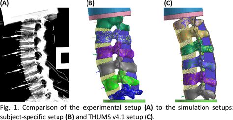Figure 1 From Subject Specific Lumbar Spine Finite Element Model Creation And Validation Using