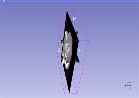 Create Dicom Series From  Images Support 3d Slicer Community