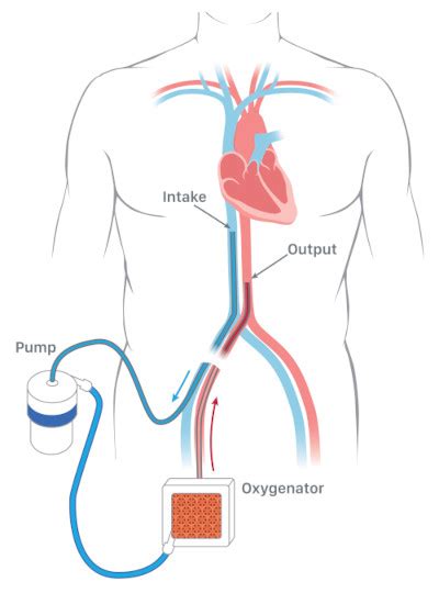 Extra Corporeal Membrane Oxygenation Ecmo Therapy Cooper University
