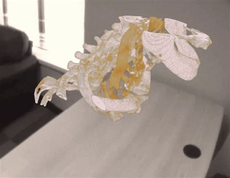 Create Medical Visualizations On Augmented Reality Headsets With Vtk Js