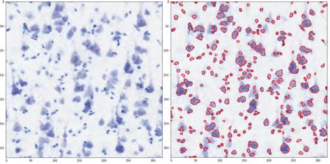nissl stained sections segmentation using algorithms of mathematical